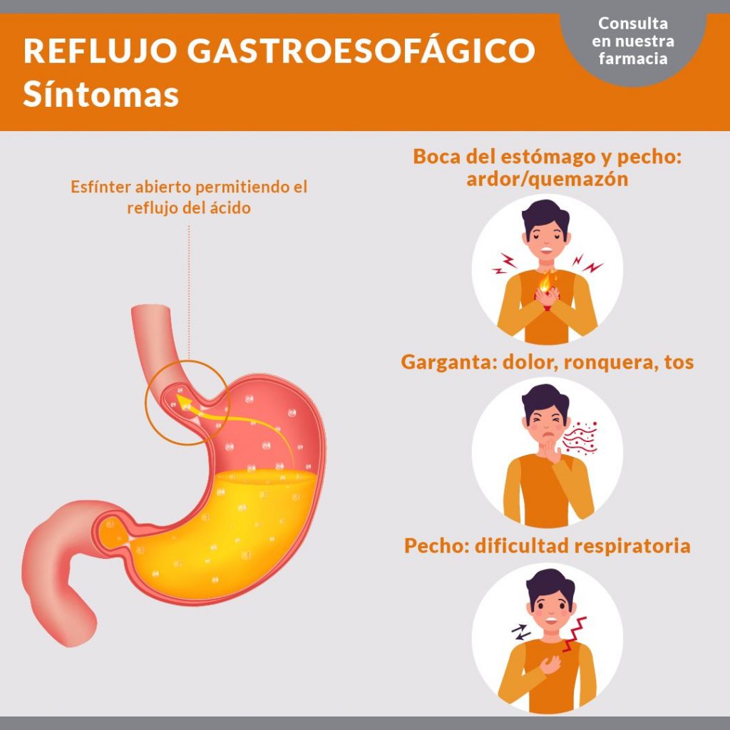 ¿Qué es el reflujo gastroesofágico? - Farmacia Calderón